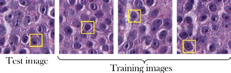 Figure 1 From Simultaneous Sparsity Model For Histopathological Image