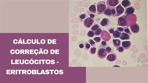 Cálculo De Correção De Leucócitos Eritroblastos No Sangue Periférico Youtube