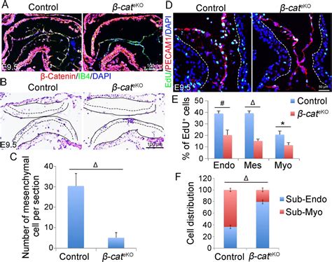β Catenin Regulates Endocardial Cushion Growth By Suppressing P21