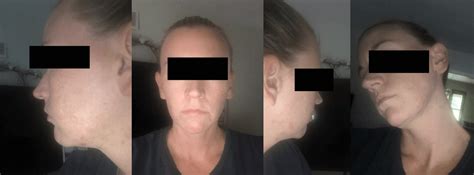 Online Dermatologist Review And Promo Code