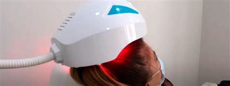 Láser para fortalecer tu pelo Imema injerto capilar y medicina estética