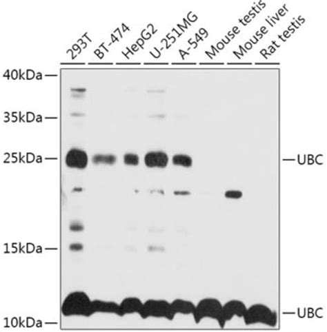 Ubiquitin C Polyclonal Antibody Invitrogen 100 μl Unconjugated