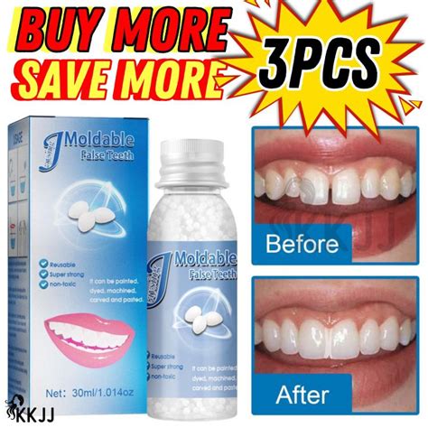 Mochi Buy 1 Take 1 Temporary Tooth Repair Kit Teeth And Gaps Moldable