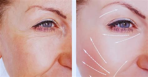 How To Use Patch Tool In Photoshop Retouching Labs