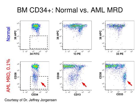 Ppt Monitoring Of Minimal Residual Disease Principles And