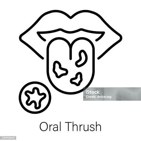 Oral Thrush Stock Illustration Download Image Now Thrush Yeast