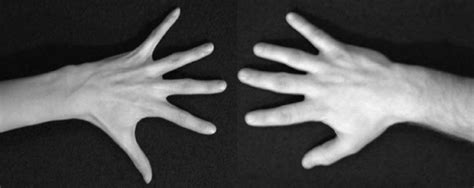 The Results From Affine Hand Registration Left The Registered Hand Download Scientific