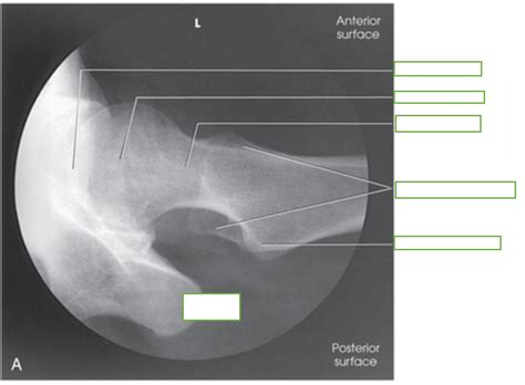 Cross Table Lateral Hip Diagram Quizlet