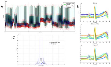 powerline noise elimination in biomedical signals via blind source