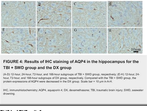 Figure 3 From The Effect Of Dexamethasone On Neuroinflammation And