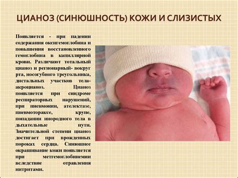 Фото Синего Носогубного Треугольника —