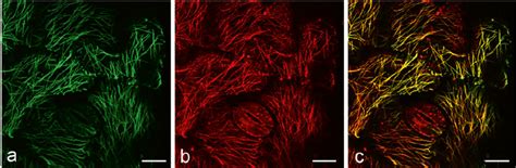 Immunolabeling Of Tubulin A And Mor1 B In Wild Type Background