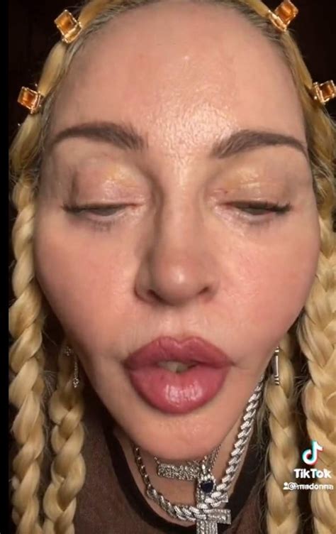 Madonnas Face Then And Now