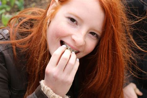 Eating With Braces An Orthodontists Guide Ghosh Ortho