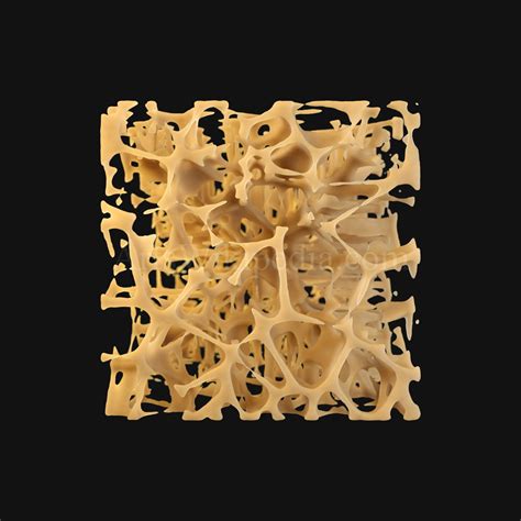 Artstation 3d Osteoporosis Histology Of Spongy Bone Structure Resources