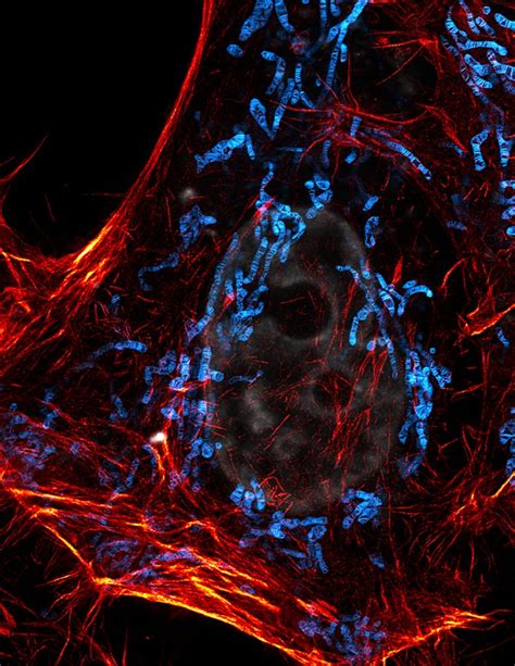 Proc Natl Acad Sci Usa 研发新探针实现线粒体多色sted成像生物科技健康一线资讯