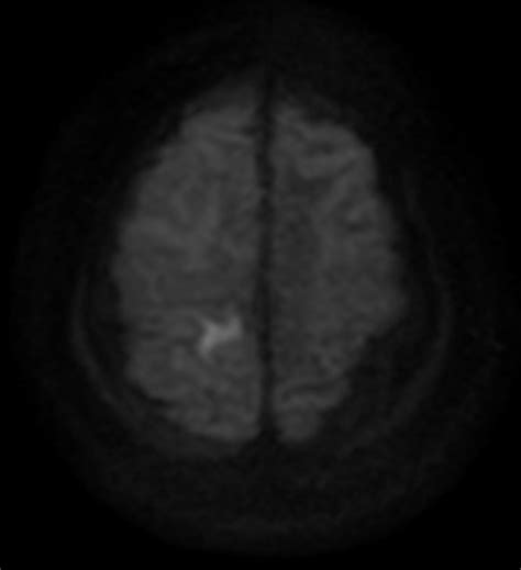 MRI Simulation With DWI TSE And FLAIR Philips MR Body Map