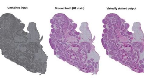 Ai Based Method Developed To Replace Chemical Staining Of Tissue