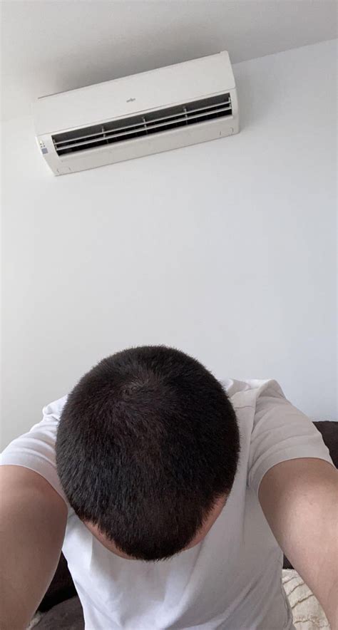 Finasteride Only 1 Year Progress R Tressless