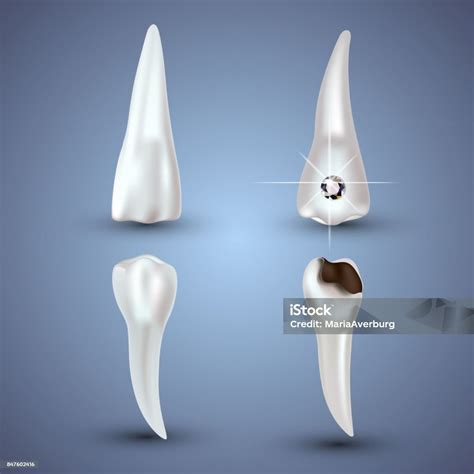 3d 현실 깨끗 하 고 더러운 회색 배경에 고립 된 치아의 벡터 집합입니다 치과 건강 개념입니다 구강 치료 치아 복원 벡터에
