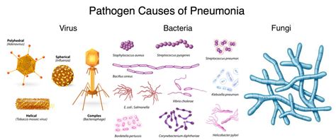 Pneumonia Bacterial Pictures