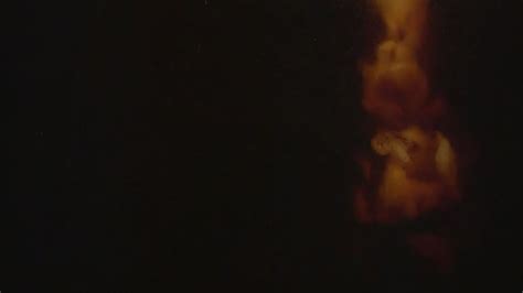 Srinidhi Cherukuri On Linkedin Innovation