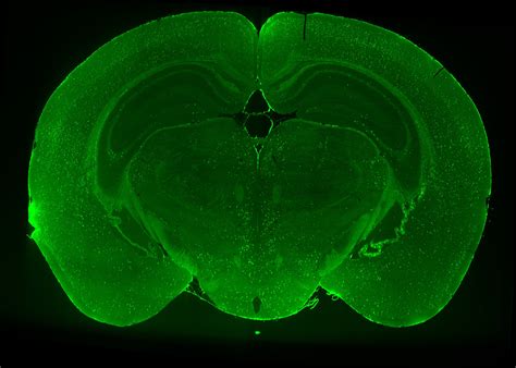 Human Tissue Core — Norc