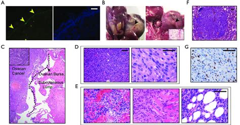 Oncogenic Kras Activation And Pten Deletion Induced Formation Of Download Scientific Diagram