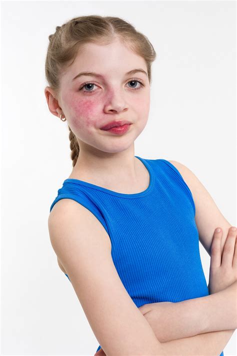 Lottie C Zebedee Talent Models With Disabilities Visible