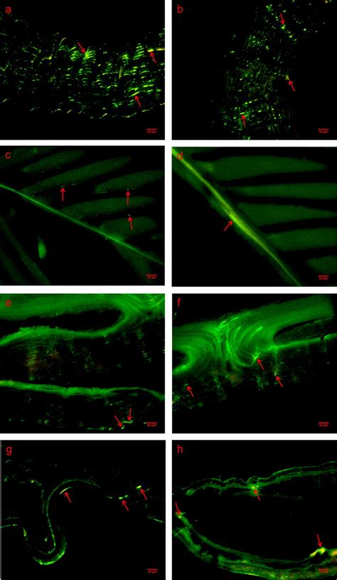 The Fluorescence In Situ Hybridization Cdna Probe Of Aglaobpa Female