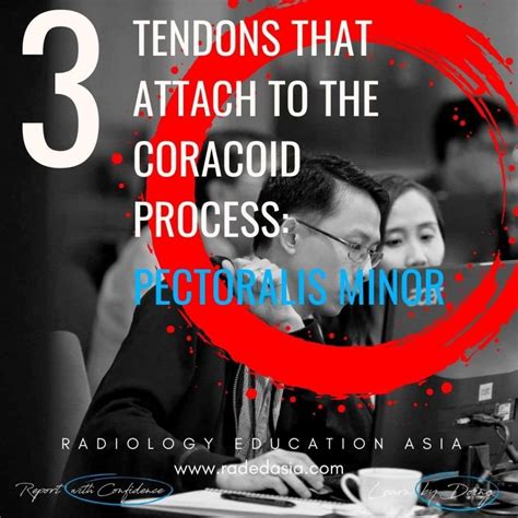 Coracoid Process Archives Radedasia