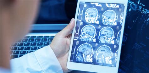 Radiology Test Questions And Answers Attempts Quiz Flashcards Trivia