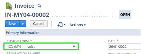 Print Button Missing Rnetsuite