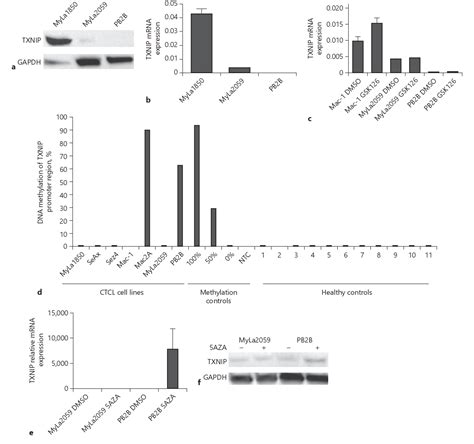 Figure 2 From The Thioredoxin Interacting Protein Txnip Is A Putative Tumour Suppressor In