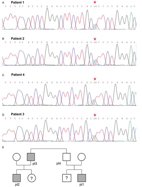Sanger Sequencing Validation Of Tp53 Mutation Detected In Patient 1