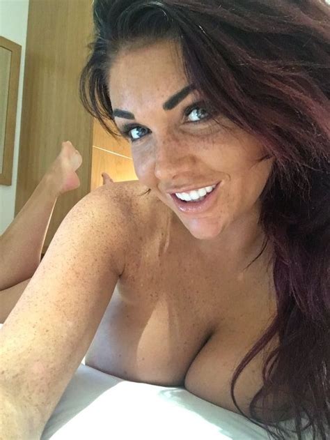 Freckles Are Sexy Pic