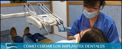 Cómo cuidar tus implantes dentales Clínica Dental Doctores Blanco
