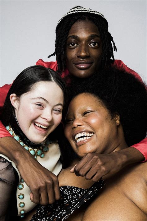 Ellie Goldstein Ist Das Neue Gesicht Von Gucci Beauty Die Welt Soll
