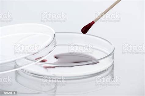 흰색 배경에 의료 실험실의 페트리 접시에 혈액 또는 빨간색 액체를 면봉으로 클로즈업 분석 및 진단 개념 0명에 대한 스톡 사진