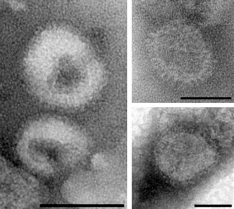 Figure 2 From Rift Valley Fever Virus Subunit Vaccines Confer Complete