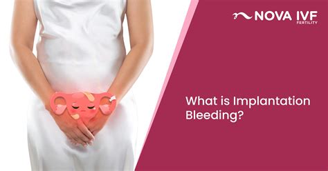 What Is Implantation Bleeding And When Does It Occur