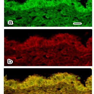 Immunofluorescent Images Of Double Staining For Gal 3 And V 3