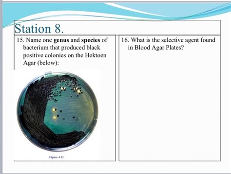 Solved Station 8 16 What Is The Selective Agent Found In