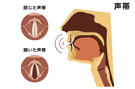 声帯ポリープとはどのような病気ですか？ ｜声帯ポリープ