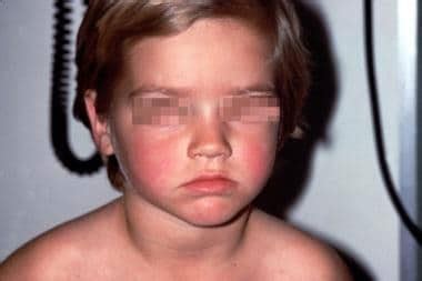 Links sobre infecções: 2013