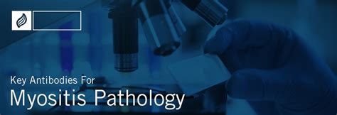 Key Antibodies For Myositis Pathology Biocare Medical