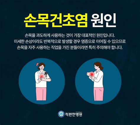 보호대 착용해도 시큰거리는 손목 주사치료로 개선 서원동정형외과