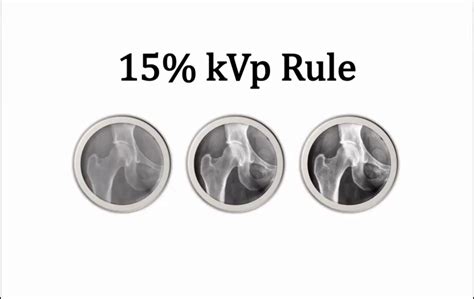 15 Rule Equation And Practice Video Lesson Clover Learning