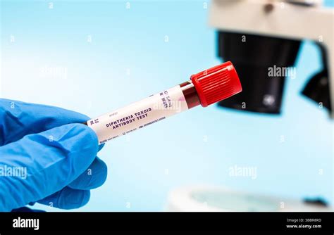 Diphtheria Toxoid Antibody Test Detects Antibodies To Diphtheria Toxoid Indicating An