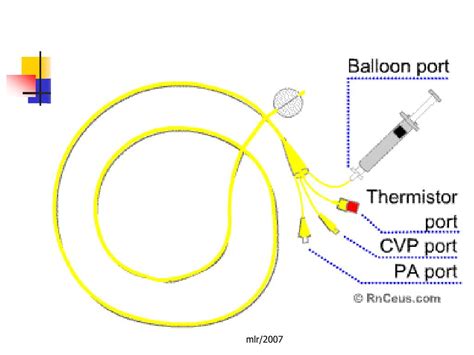 Ppt Hemodynamic Monitoring Powerpoint Presentation Free Download